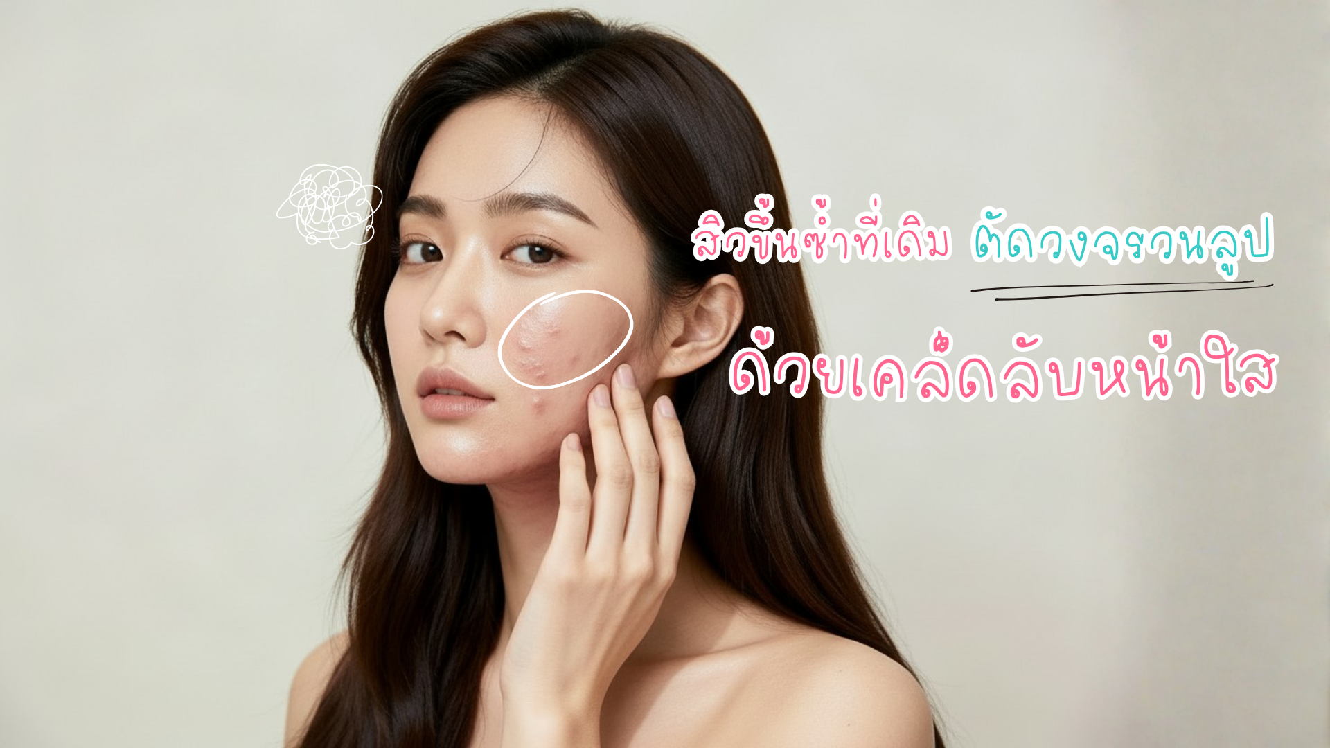 สิวขึ้นซ้ำที่เดิม? ตัดวงจรวนลูป ด้วยเคล็ดลับหน้าใส – SOUL YOUNG